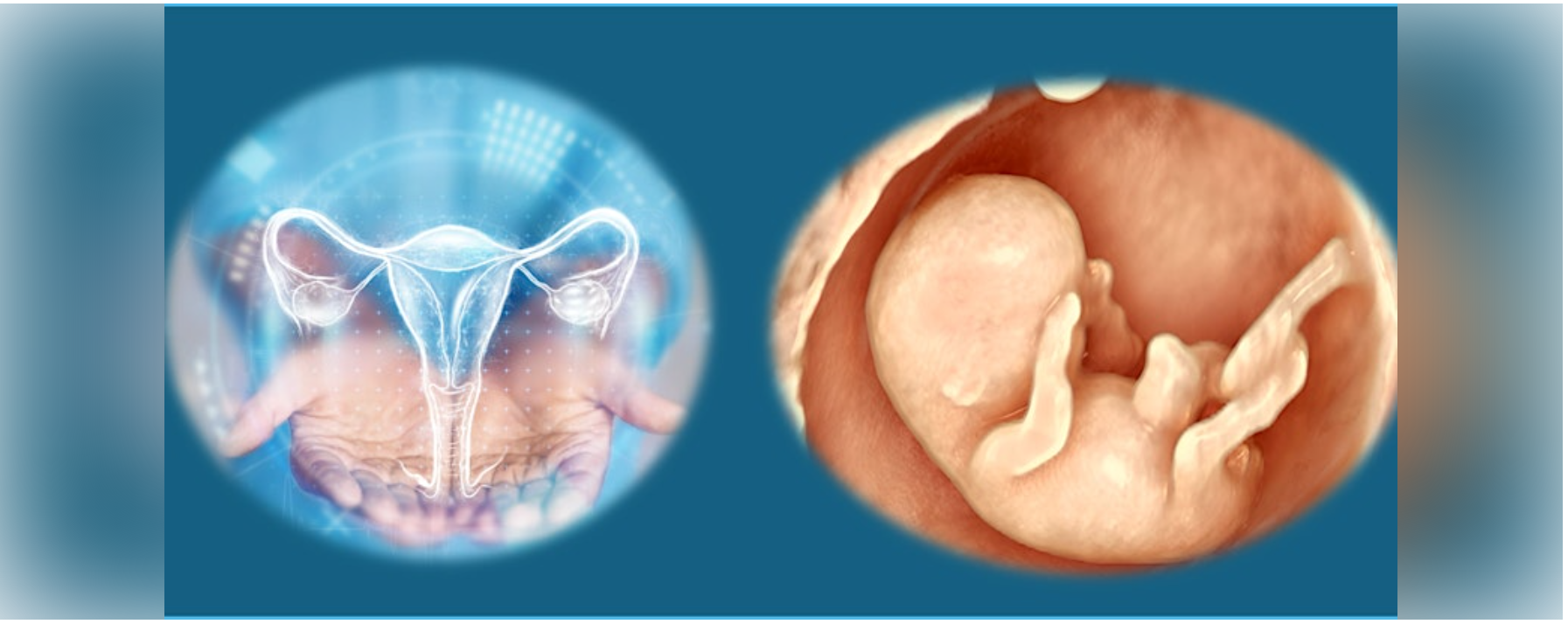 29th Annual Gynecological & First Trimester Imaging: Setting the ...